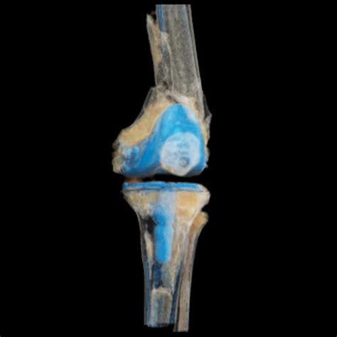 Stanford 3d And Quantitative Imaging Laboratory On Linkedin 3dimaging