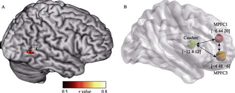 A Voxel Level Analysis Results B The Functional Connection Values Download Scientific