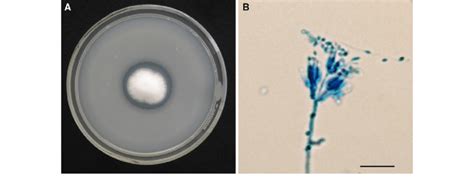 Colony Morphology And Zone Of Solubilization A And Microscopic Download Scientific Diagram