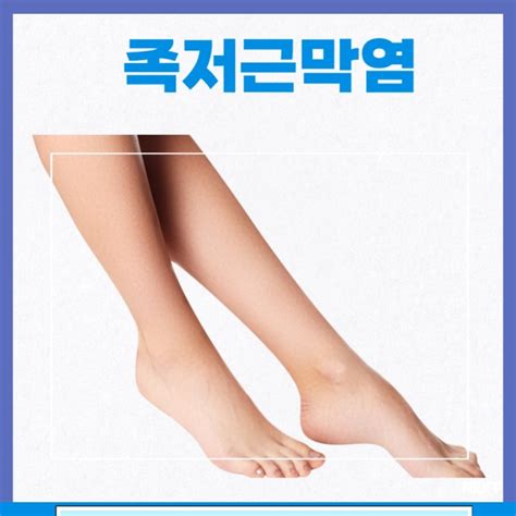 족저근막염 자가치료 증상 원인 발바닥통증 발뒤꿈치통증 운동 네이버 블로그