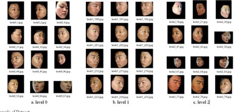 Figure 2 From Implementation Of Convolutional Neural Network Cnn In Android Based Acne