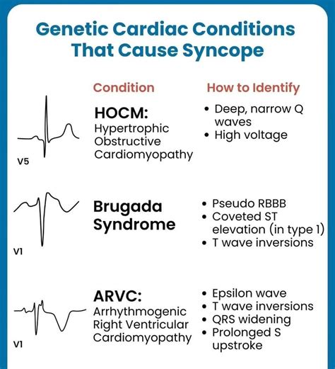 The Heart 🔴genetic Cardiac Conditions That Cause Syncope ⤵️ 🔹ecg