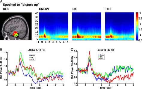 A Beamformer Extracted Time Frequency Wavelet Plots 5 40 Hz For