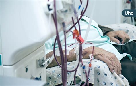 洗腎讓皮膚黑、西藥增加腎負擔⋯？腎臟科醫親解「洗腎」5大迷思uho優活健康網