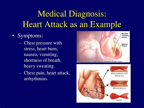 Ppt Dsp Biomedical Signal Processing Powerpoint Presentation
