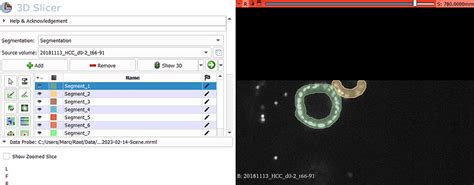 Extract Segment Labelmap As 2d Slices Support 3d Slicer Community