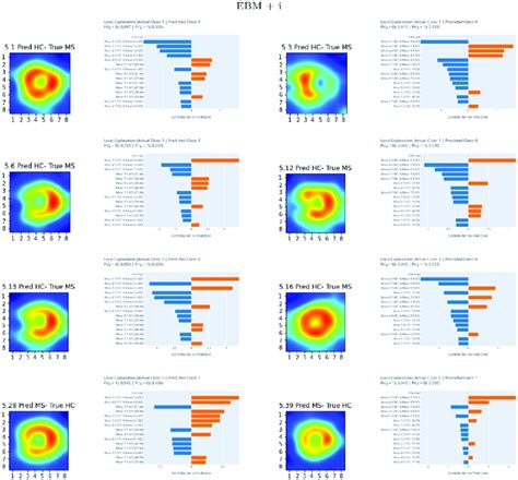 Local Explainable Boosting Machine With Interactions Ebm I Results