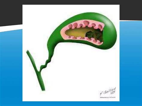 Focal Vs Diffuse Gall Bladder Wall Thickening Ppt