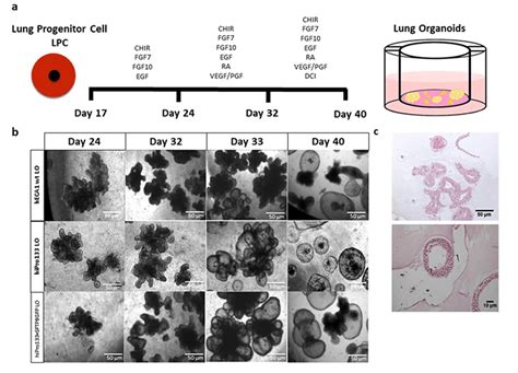 Laboratory Lungs The Implications Of Lung Organoids For Health And