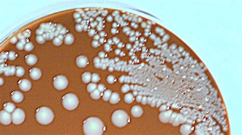 Bacillus Cereus La Bacteria Que Puede Intoxicarte Cuando No Conservas