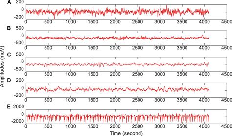 Frontiers Eeg Feature Selection Via Stacked Deep Embedded Regression