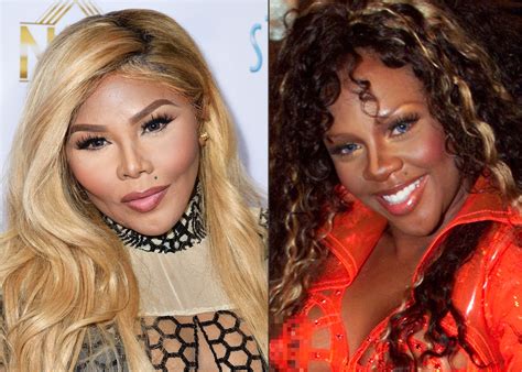 Lil Kims New Face A Plastic Surgeon Weighs In Zestvibe