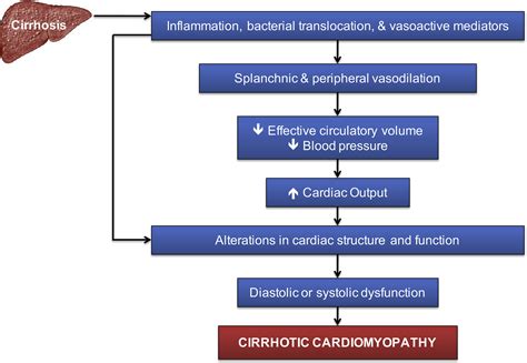 Current Concepts Of Cirrhotic Cardiomyopathy Clinics In Liver Disease
