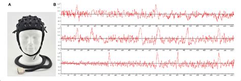 Electroencephalographic EEG Experiment And Waveform A Schematic Download Scientific