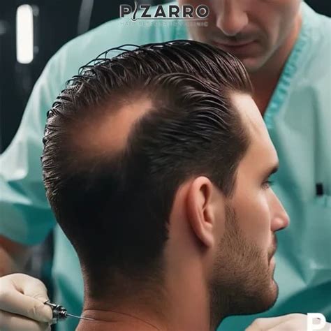 Video Pizarro Hair Restoration Clinic On Linkedin