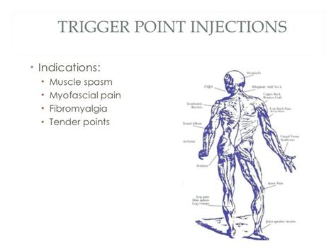 Basic Spine Injections