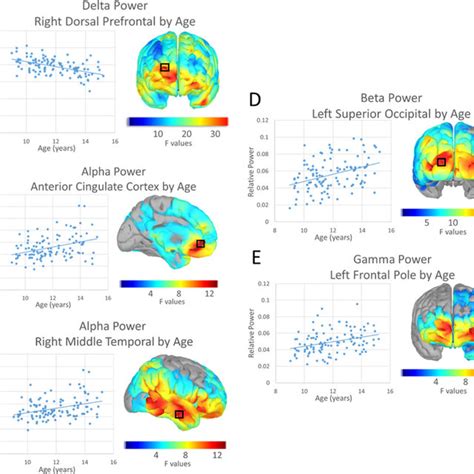 Main Effect Of Sex Box And Whisker Plots Display Significant Sex