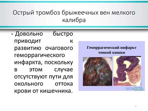 Этиология и патогенез тромбоза мезентериальных сосудов презентация онлайн