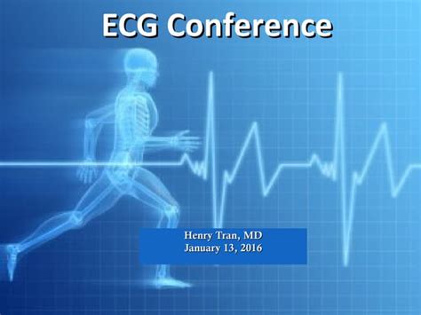 Ecg Interpretation The Basics Ppt