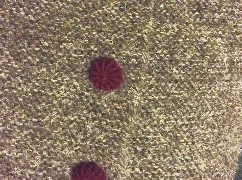 In Search Of Yorkshire Buttons Ann Kingstone