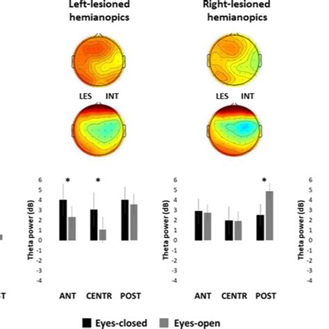 Scalp Topographies Represent The Scalp Distribution Of The Theta Power Download Scientific
