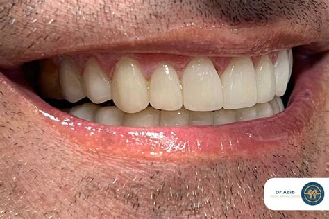 گالری دندانپزشکی دکتر ادیب