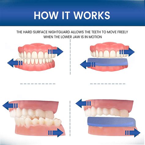Dental Defense Premium Hard Surface Nightguard 2 Pack Customizable