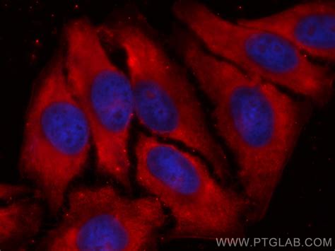 Pgam1 Antibody Cl594 67470 Proteintech