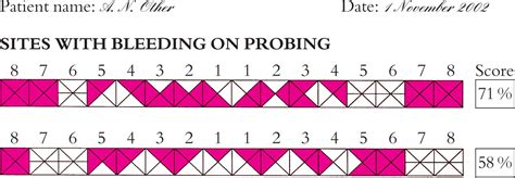 8 The Detailed Clinical Periodontal Examination Pocket Dentistry