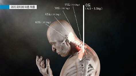 명의 목 통증 늦기 전에 원인부터 찾아야 합니다