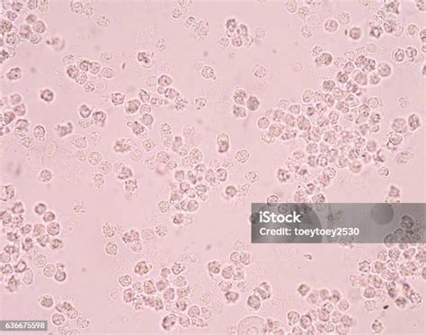 Bakteri Dalam Spesimen Urin Di Bawah Mikroskop 40x Foto Stok Unduh