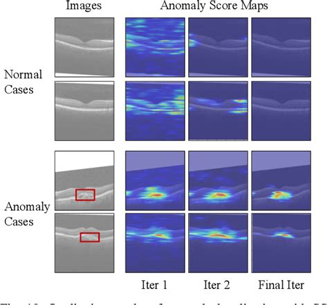 Figure From Self Supervised Masking For Unsupervised Anomaly Detection And Localization