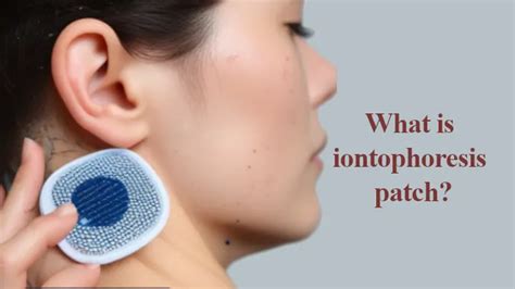 What Is Iontophoresis Patch How Does Work And Side Effects