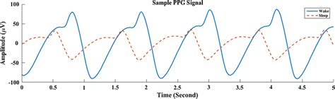 Sample Photoplethysmography Signal Download Scientific Diagram