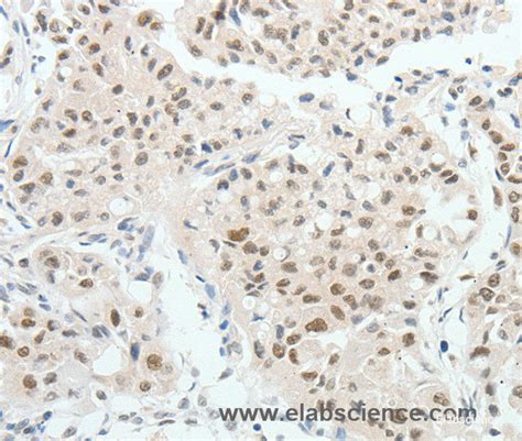 High Affinity And Specificity Hnf1b Polyclonal Antibody E Ab 12661 At
