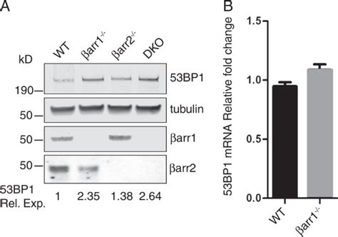 βarrestin 1 Regulates Dna Repair By Acting As An E3 Ubiquitin Ligase