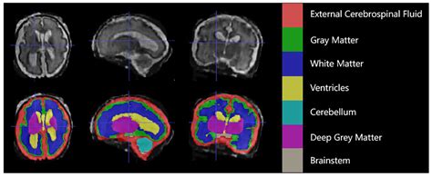 U Net For Brain Segmentation In Pytorch