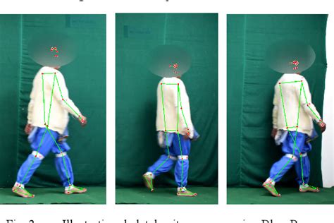 Figure 3 From Improving Knee Osteoarthritis Classification With