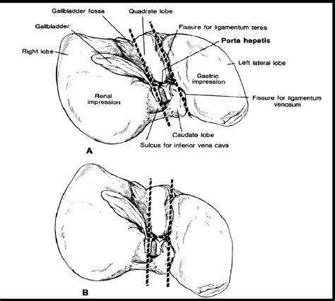 Porta Hepatis And Features Of The Visceral Surface Of The Liver A