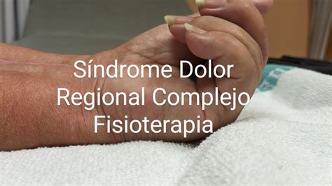 Síndrome Dolor Regional Complejo fisioterapia YouTube