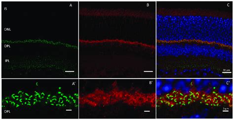 Hrg4 Unc119 Is Expressed In The Outer Plexiform Layer Of Murine Download Scientific Diagram