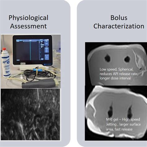 Integrated Approach Towards Optimizing Delivery Download Scientific Diagram