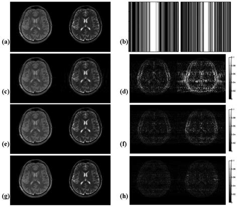 Multi Contrast Reconstruction With Bayesian Compressed Sensing