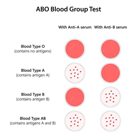 Premium Vector Abo Blood Group Test