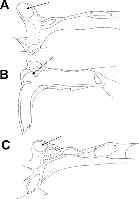 Right Side Lateral View Of Pterotic Sensory Canal Opening Download