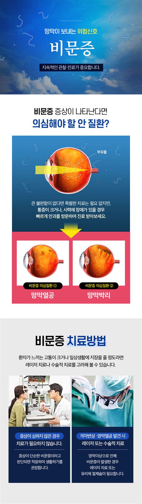 하늘안과의원 망막클리닉