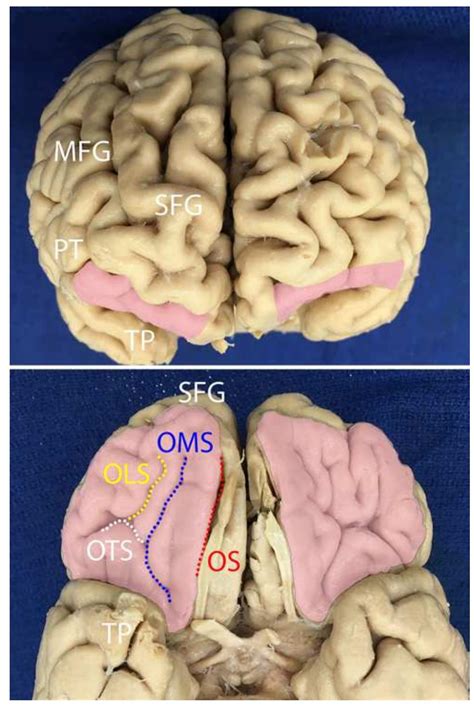 Superficial Anatomy Of The Orbitofrontal Cortex Ofc