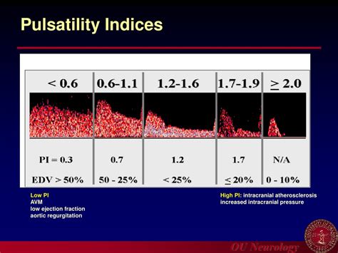 Ppt Introduction To Carotid Ultrasound And Transcranial Doppler Ultrasound Powerpoint