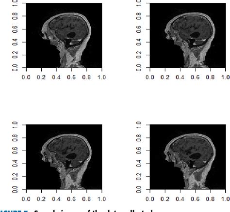 Figure 7 From Brain Mri Image Classification For Cancer Detection Using