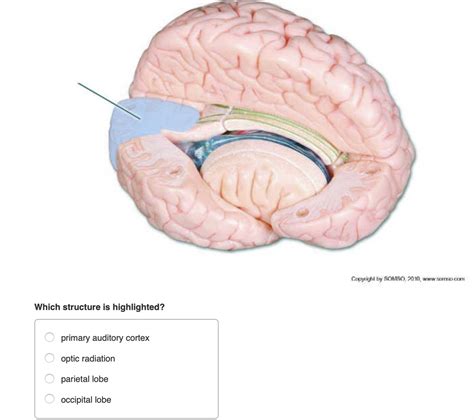 Primary Auditory Cortex